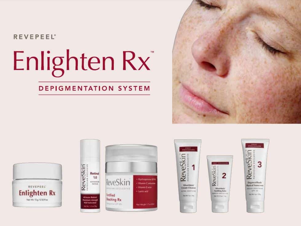 Address Skin Discoloration with Enlighten RX Treatment in Naples, FL ...
